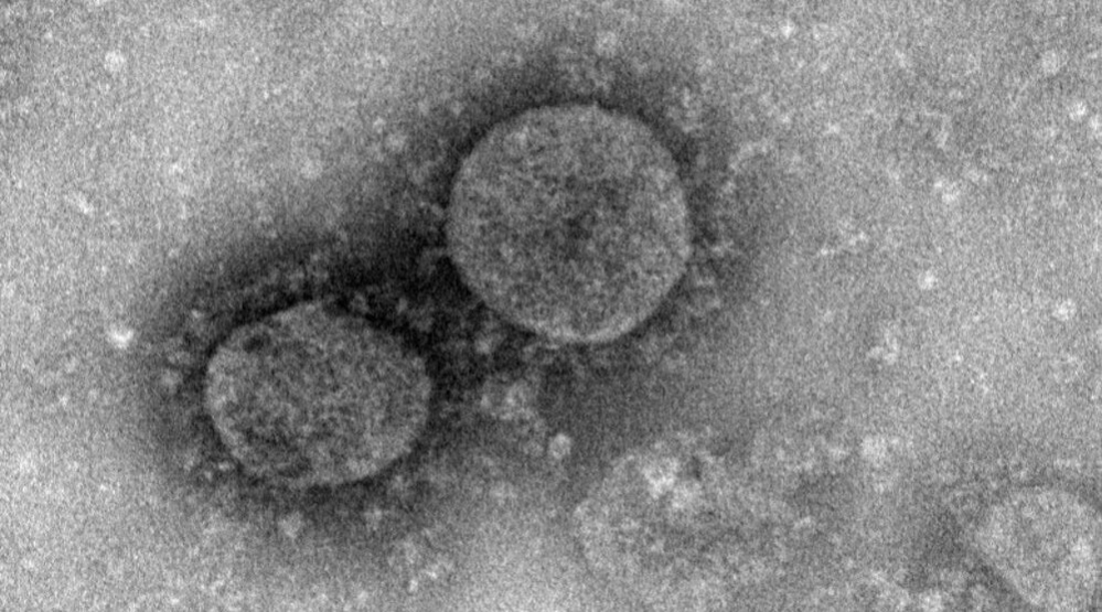Coronavirus: le prime immagini del virus 2019-nCoV | Lega Nerd